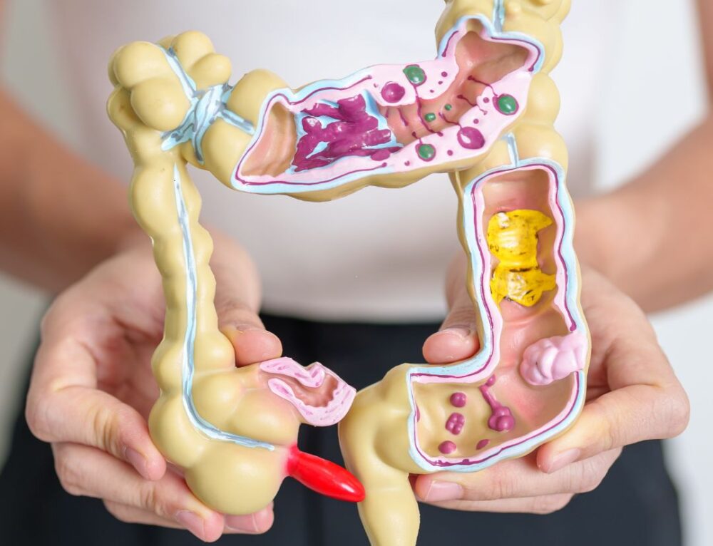 Cupping Therapy For Constipation Relief - Acupuncture Is My Life